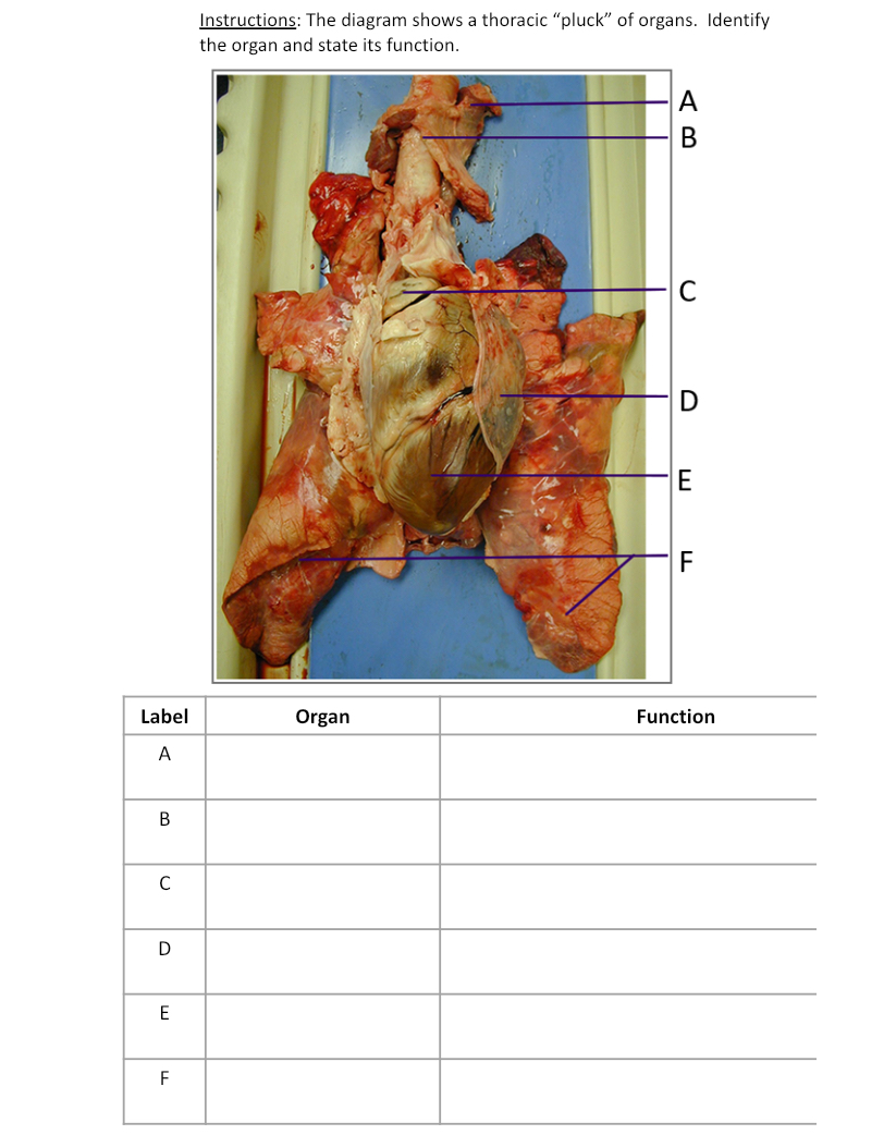 Solved Instructions: The diagram shows a thoracic "pluck" of | Chegg.com