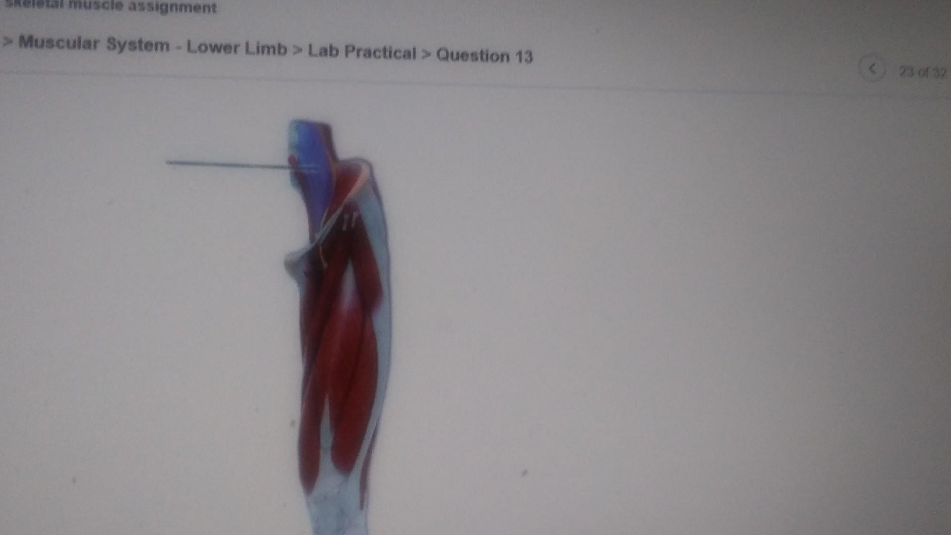 Solved Muscular System - Lower Limb > Lab Practical > | Chegg.com