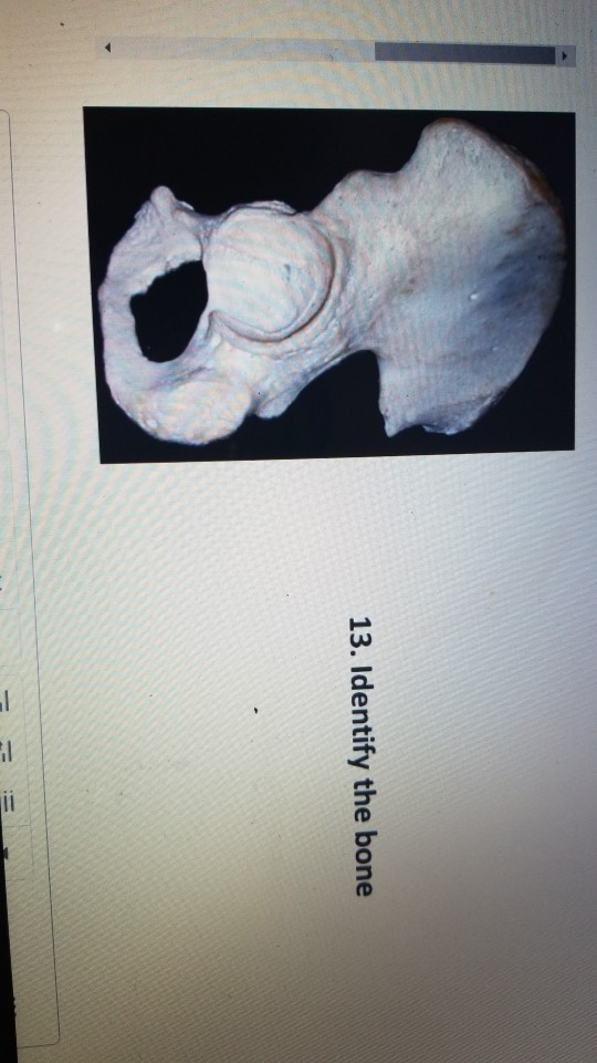 Solved 13. Identify the bone - 1 !! 14. Identify the bone | Chegg.com