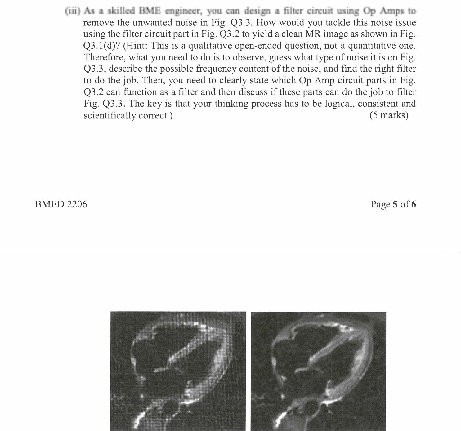 Solved (iii) ﻿As a skilled BME engineer, you can design a | Chegg.com