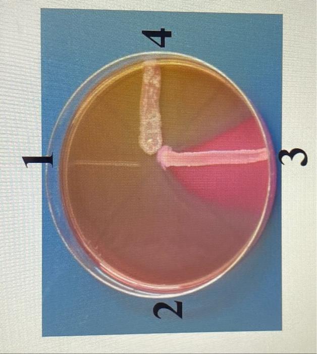 Solved Review 11.1 Homework. Unanswered You inoculate 4 | Chegg.com