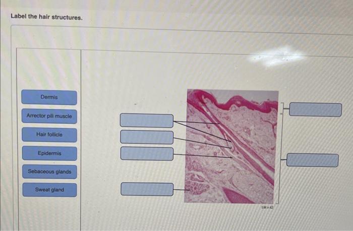 Solved Label the hair structures. | Chegg.com