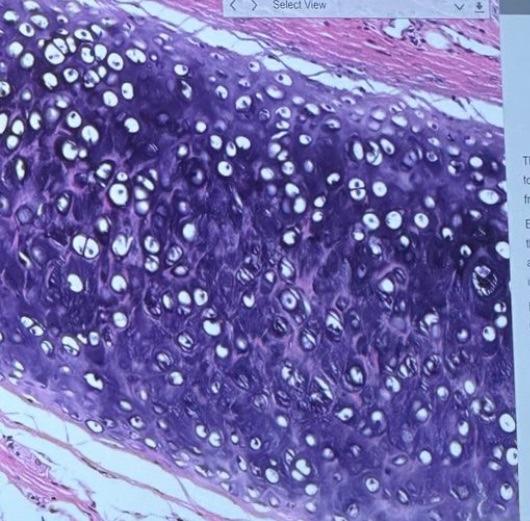 Solved name and label the nucleus , type of bone/cartilage , | Chegg.com