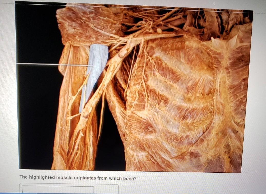 Solved Identify the highlighted muscle. The highlighted | Chegg.com