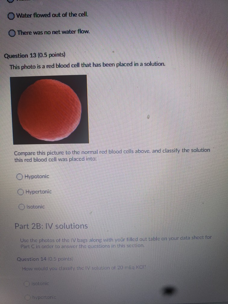 Solved Question 9 (0.5 points) This photo is of healthy red | Chegg.com