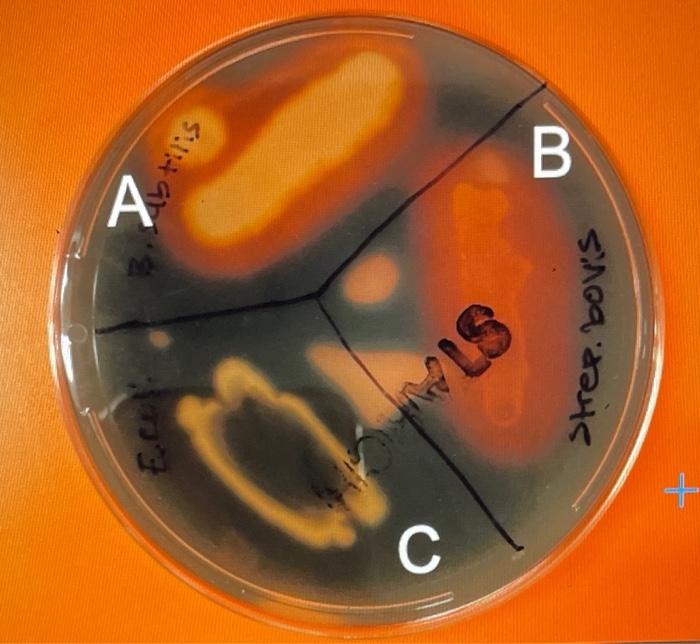 Solved which zone is positive on this starch plate? what | Chegg.com