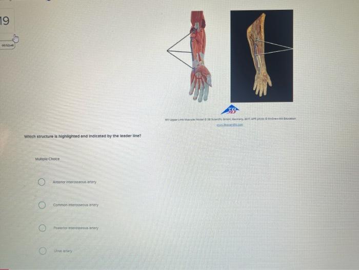 Waich structure is highlghted and indiceted by the | Chegg.com
