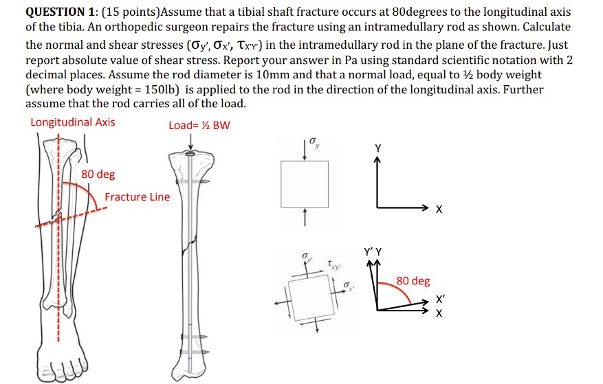 Solved QUESTION 1: (15 ﻿points)Assume that a tibial shaft | Chegg.com