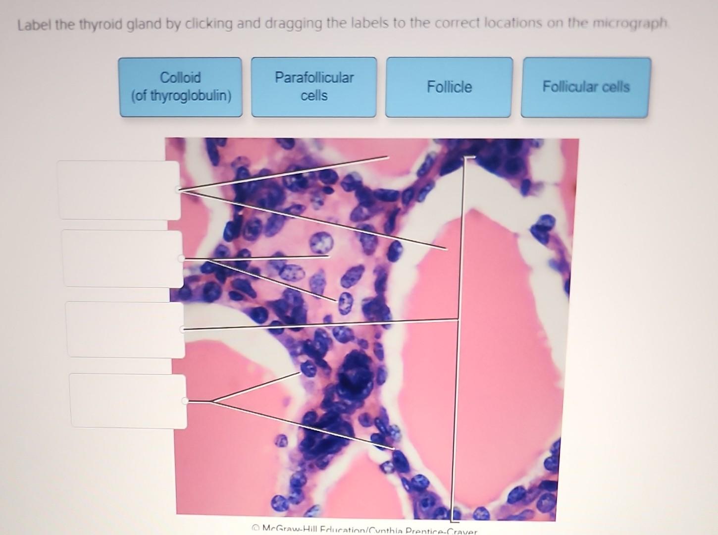 Solved Label the thyroid gland by clicking and dragging the | Chegg.com