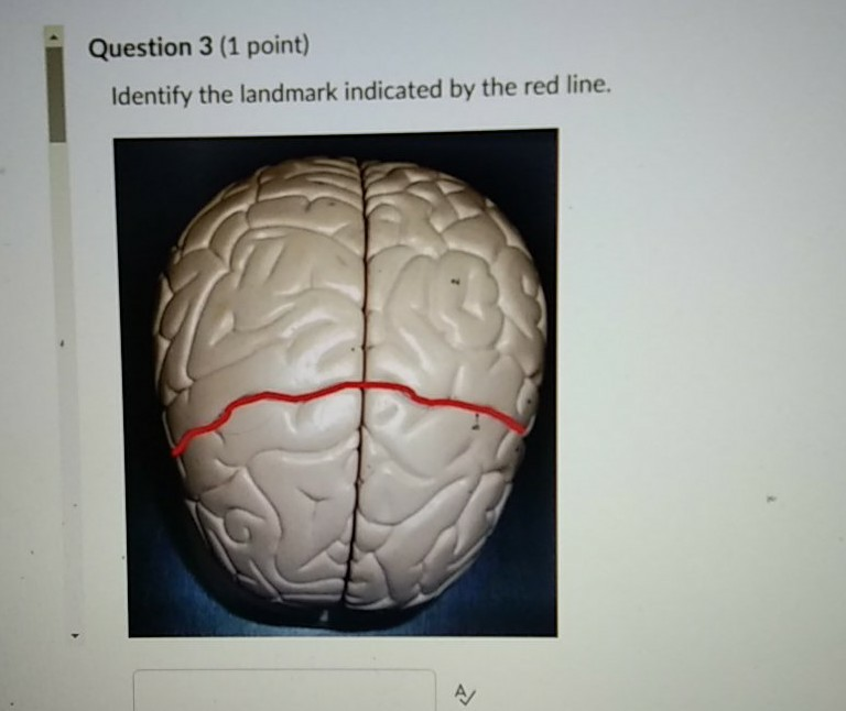 Solved Question 3 (1 point) Identify the landmark indicated | Chegg.com