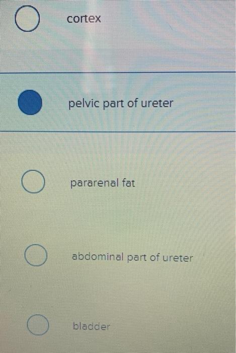 Solved Which structure is highlighted? SEGOBEE O cortex | Chegg.com