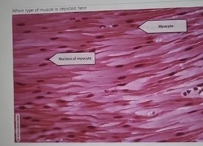 Solved Which type of muscle is depicted hwre | Chegg.com