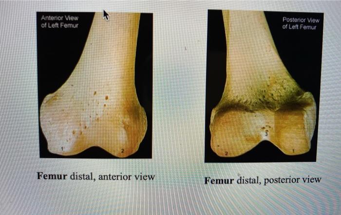Solved Lab 10: Appendicular Skeleton - Lower Appendages | Chegg.com