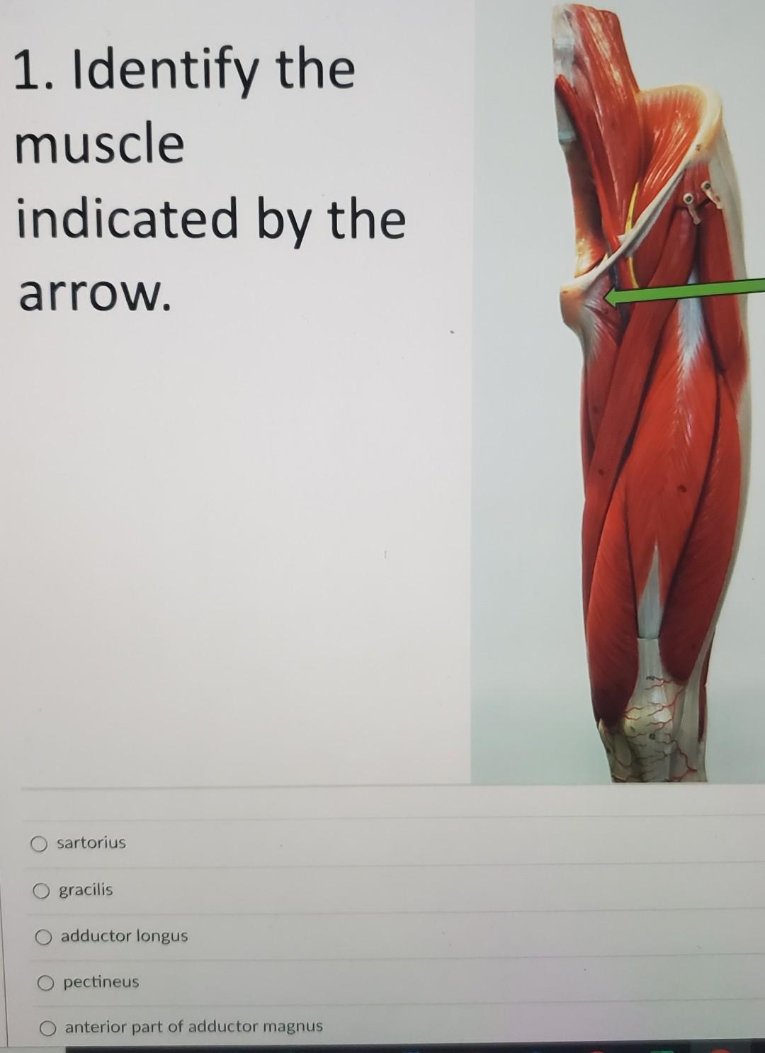 Solved 1. Identify the muscle indicated by the arrow. | Chegg.com