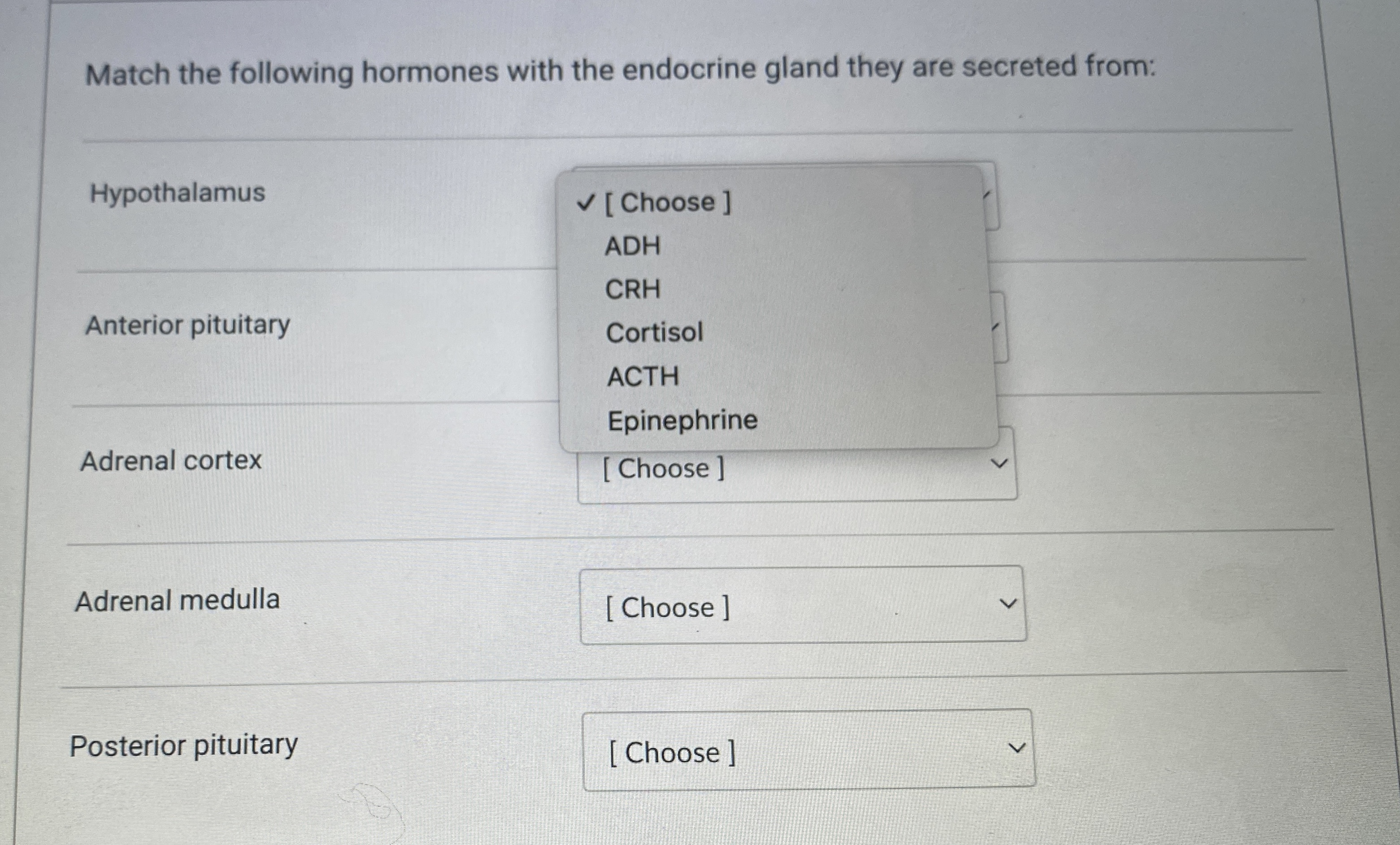 Solved Match the following hormones with the endocrine gland | Chegg.com