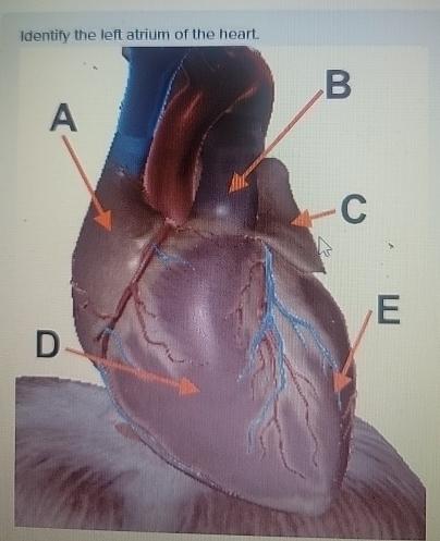 Solved Identify the left atrium of the heart | Chegg.com
