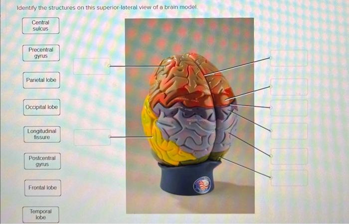 Solved Identify the structures on this superior-lateral view | Chegg.com