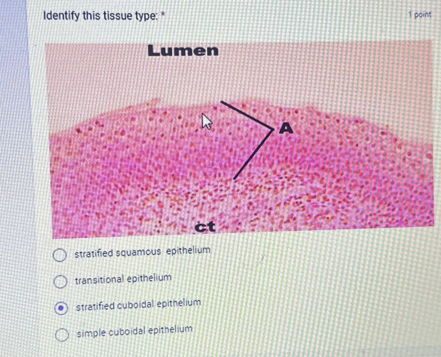 Solved Identify this tissue type:*1 ﻿pointLumenstratified | Chegg.com