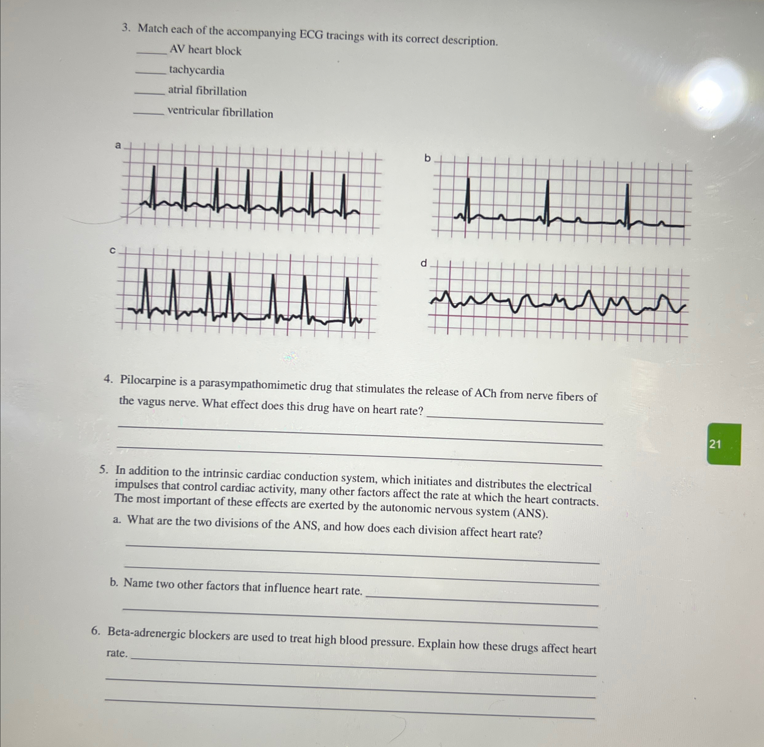 Match each of the accompanying ECG tracings with its | Chegg.com