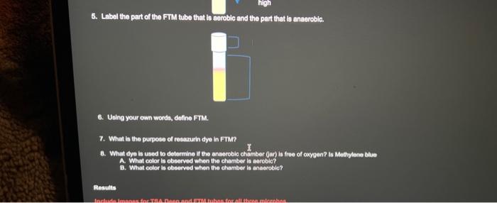 Solved 5. Label the part of the FTM tube that is aeroble and | Chegg.com