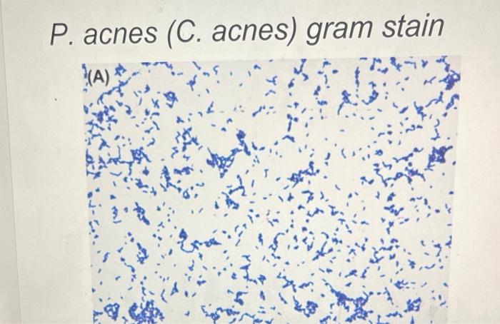 Propionibacterium acnes - Gràm positive rods - | Chegg.com