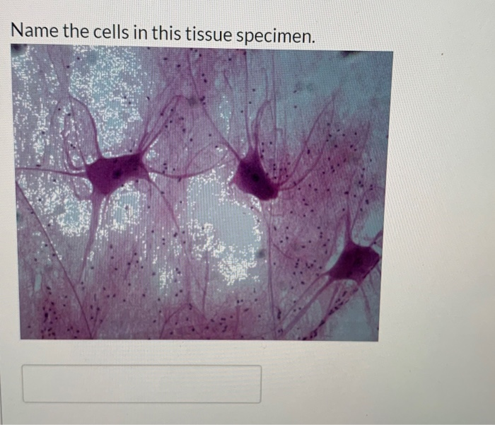 Solved Name the cells in this tissue specimen. | Chegg.com