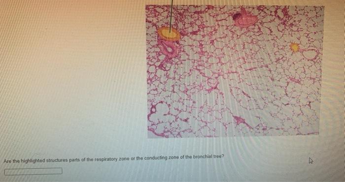 Solved Identify the highlighted layer of the arterial wall | Chegg.com