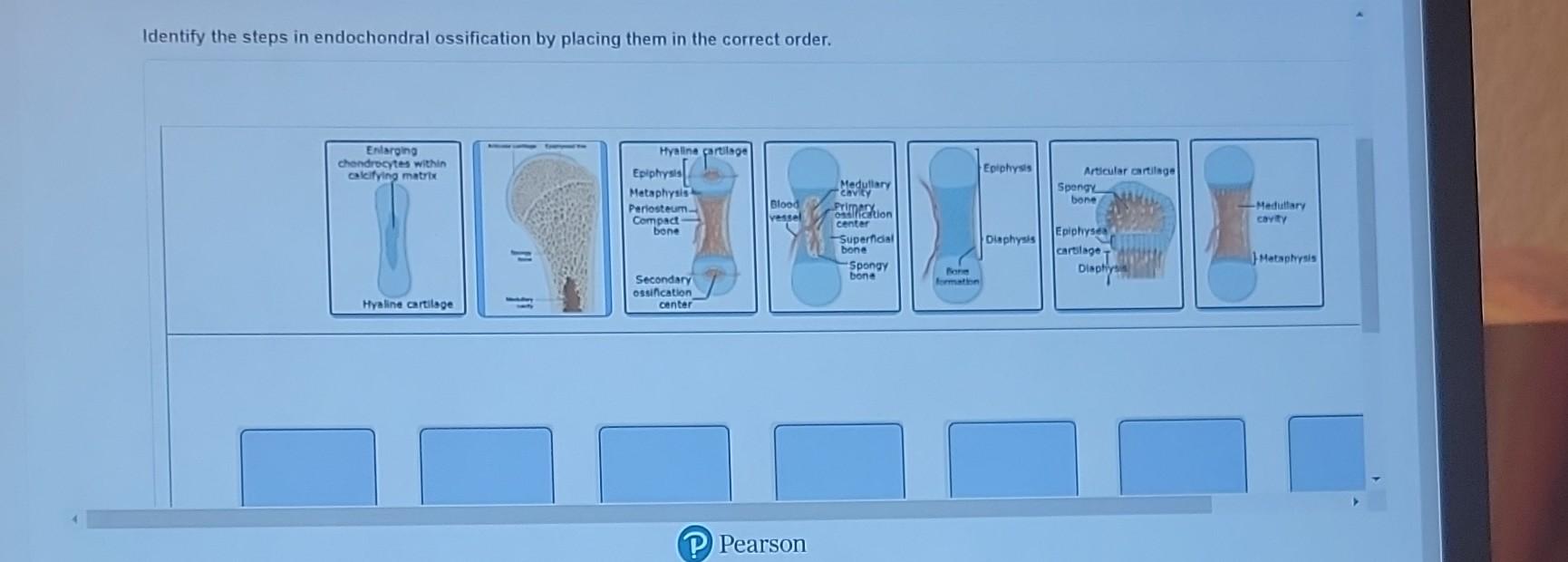 Identify the steps in endochondral ossification by | Chegg.com