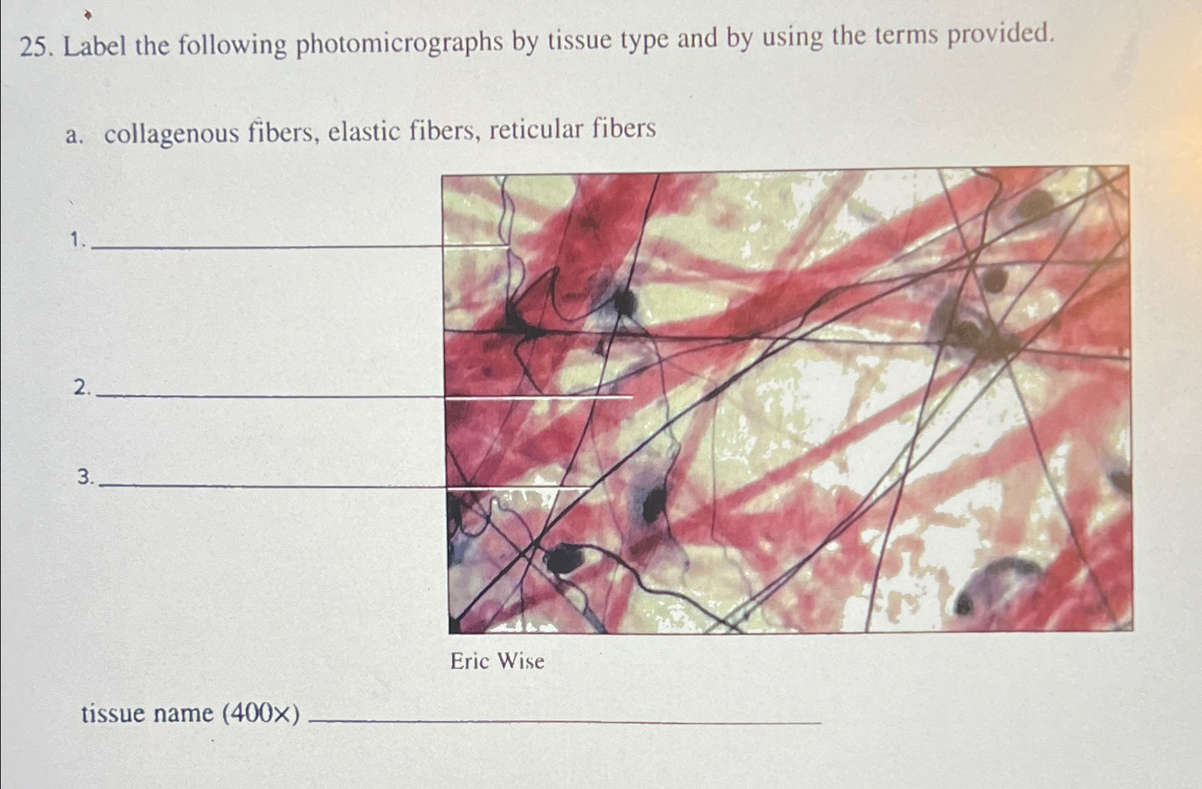Solved Label the following photomicrographs by tissue type | Chegg.com Solved Label the following photomicrographs by tissue type | Chegg.com