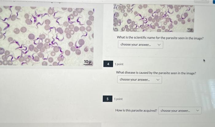 Solved What is the scientific name for the parasite seen in | Chegg.com