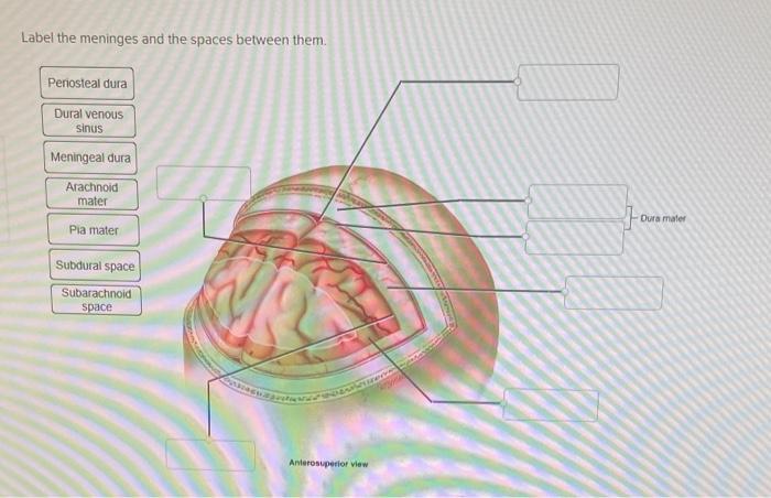 Solved Label the meninges and the spaces between them. | Chegg.com
