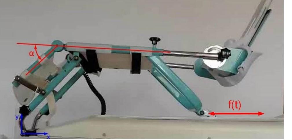 Solved how many degrees of freedom does knee Movement splint | Chegg.com