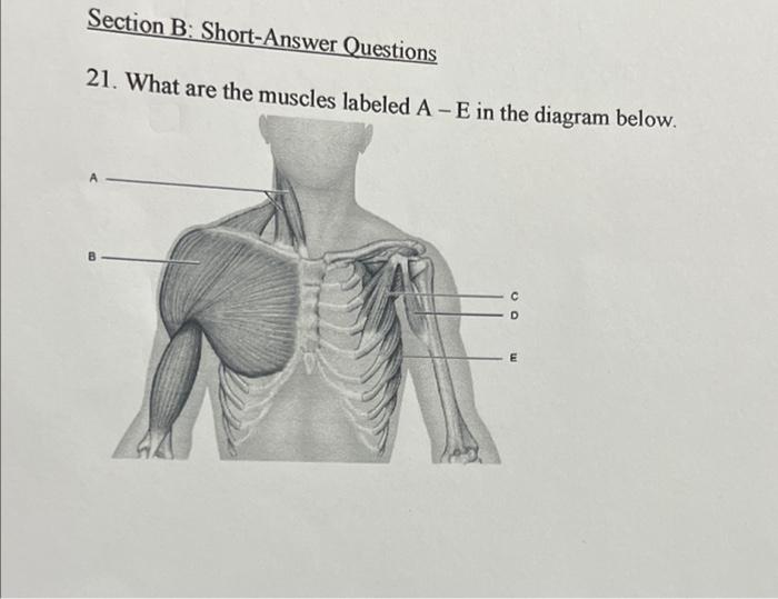 Solved Section B: Short-Answer Questions 21. What are the | Chegg.com