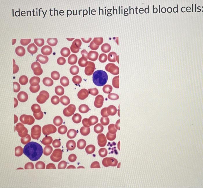 Solved Identify the purple highlighted blood cells | Chegg.com