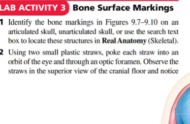 Solved LAB ACTIVITY 3 ﻿Bone Surface Markings1 ﻿Identify the | Chegg.com