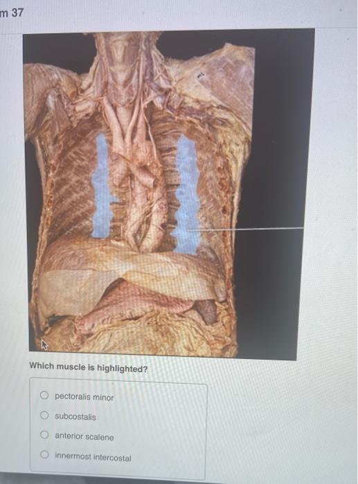 Solved Which structure is highlighted? anconeus muscle O | Chegg.com