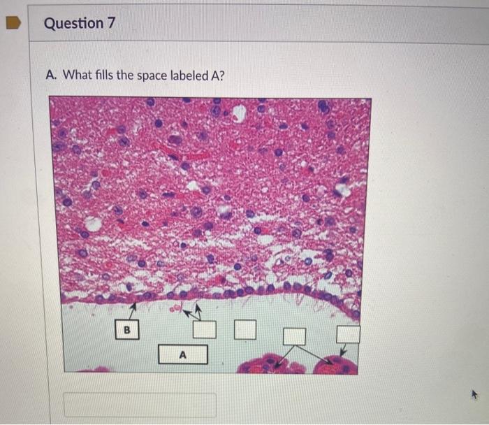 Solved Question 7 A. What fills the space labeled A? | Chegg.com
