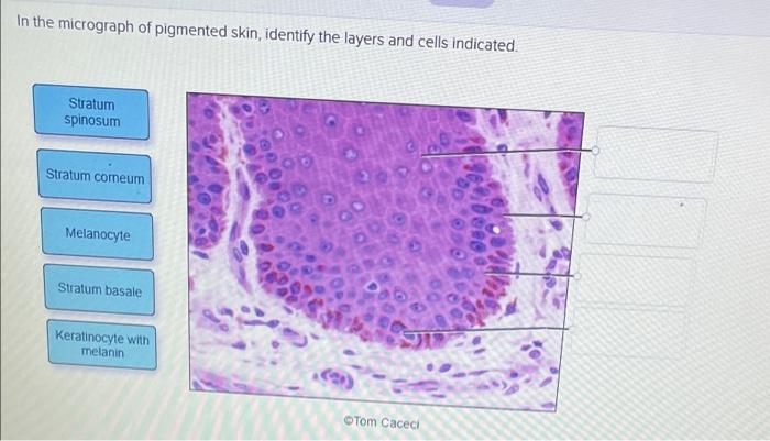 Solved In the micrograph of pigmented skin, identify the | Chegg.com