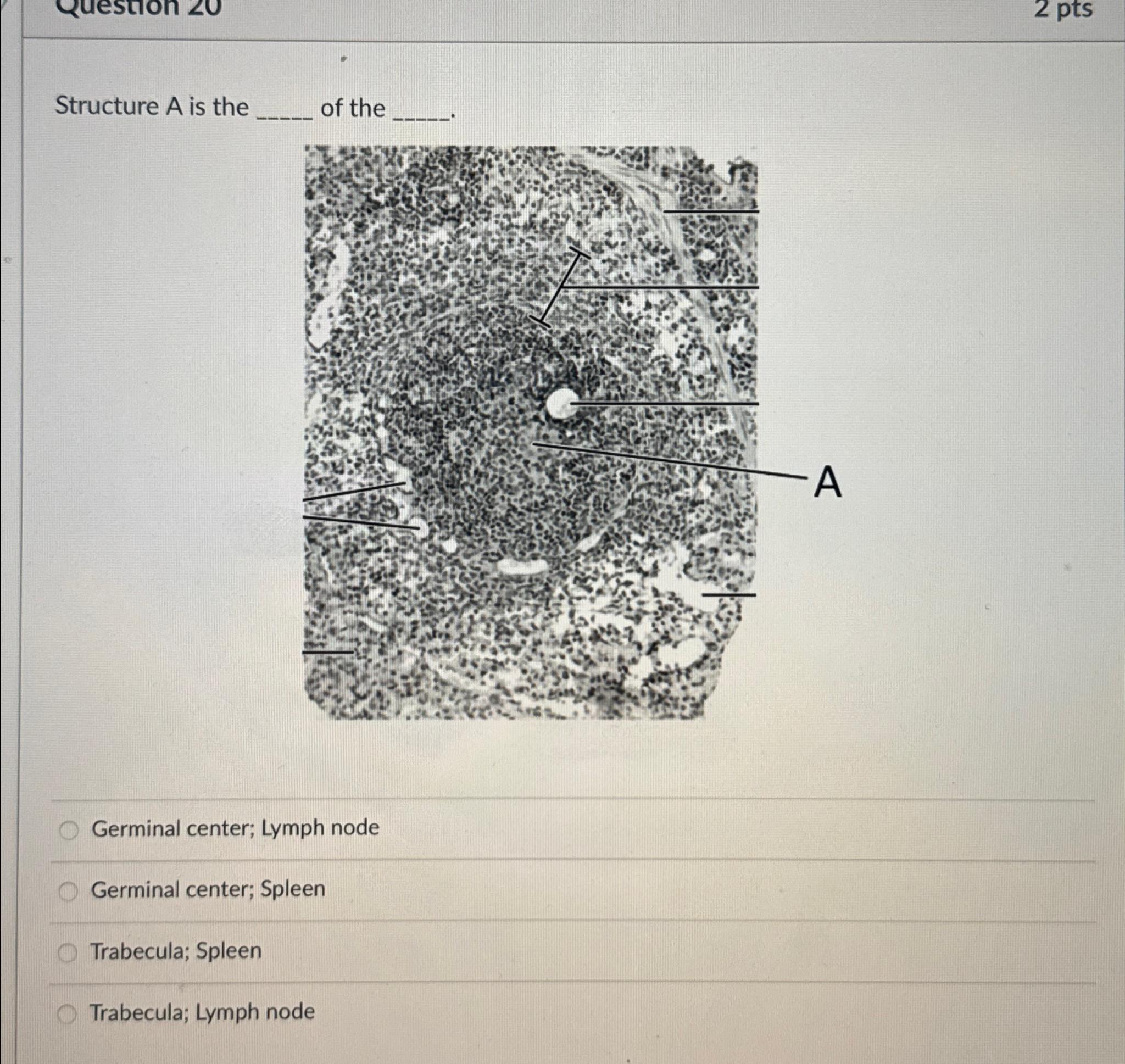 Solved Structure A is the of theGerminal center; Lymph | Chegg.com