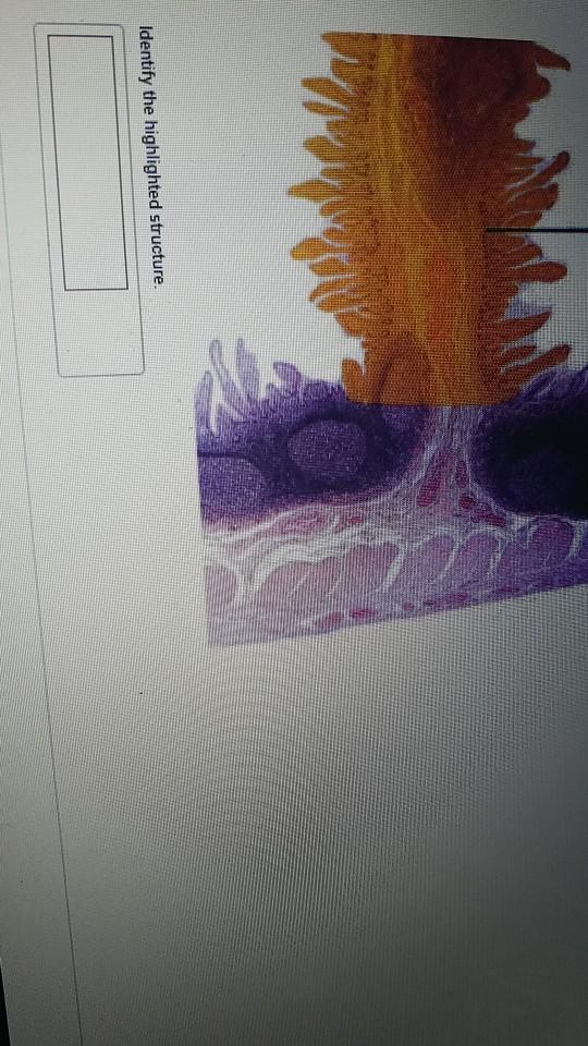 Solved Identify the highlighted structure. | Chegg.com