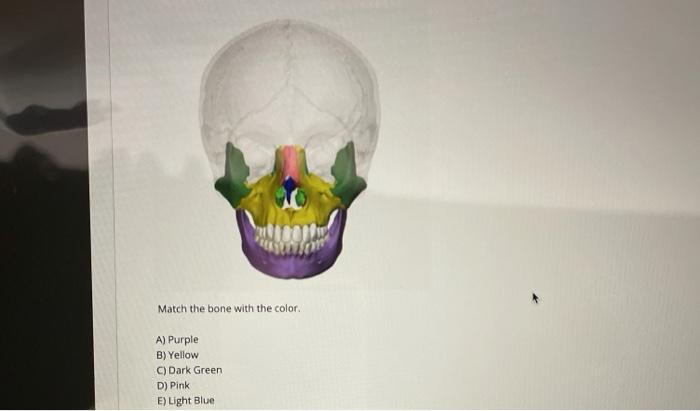 Solved Match the bone with the color. A) Purple B) Yellow C) | Chegg.com