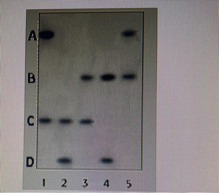 Solved results from a multiallelic single locus probe DNA | Chegg.com