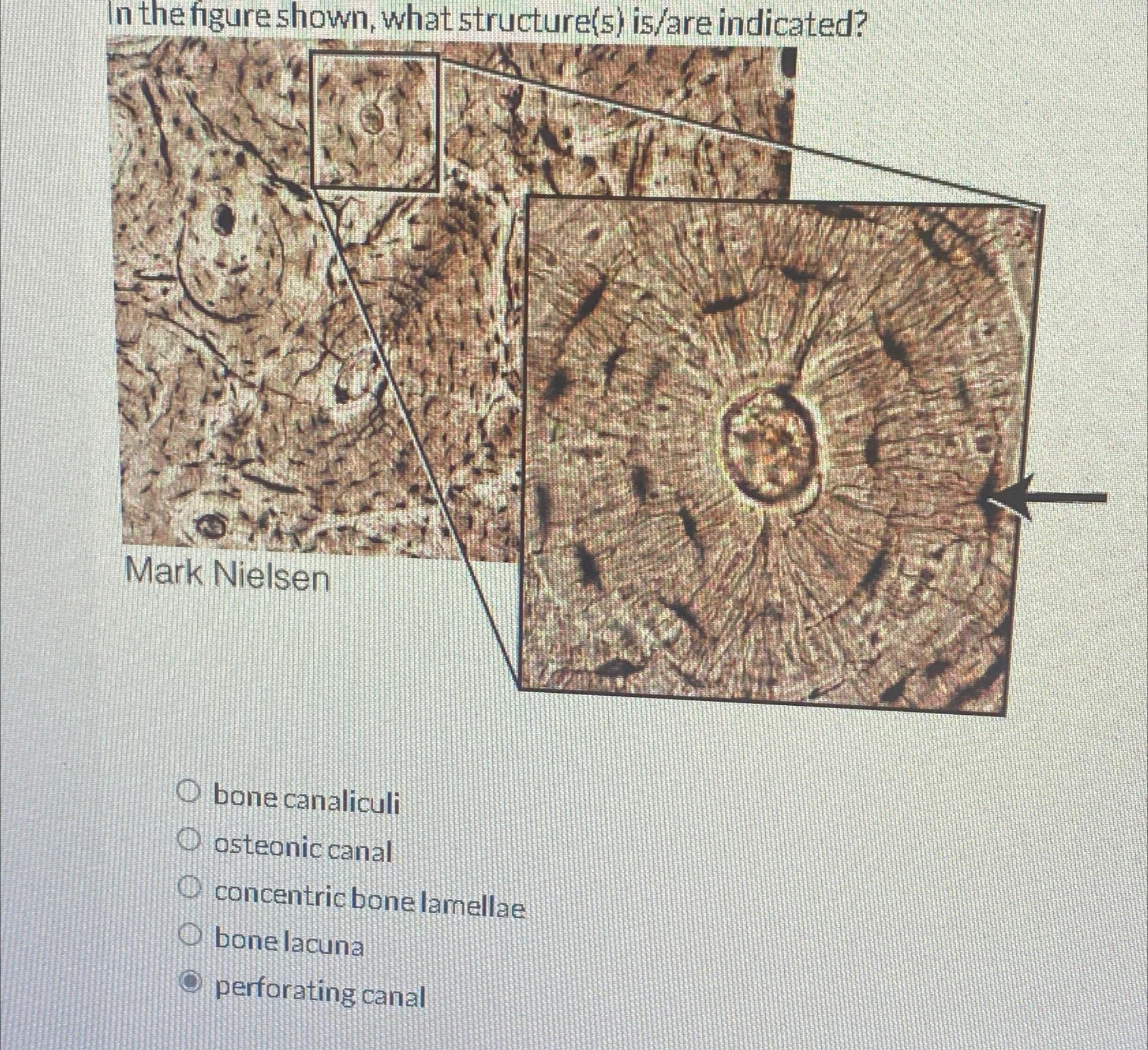 Solved In the figure 5 ﻿hown, what structure (5) ﻿is/are | Chegg.com