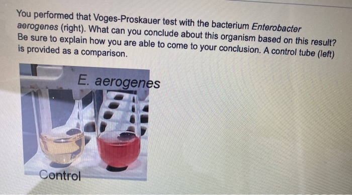 Solved You performed that Voges-Proskauer test with the | Chegg.com