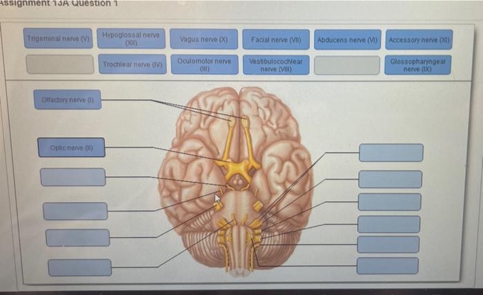 Solved Assignment 13A Question 1 Trigeminal nerve | Chegg.com