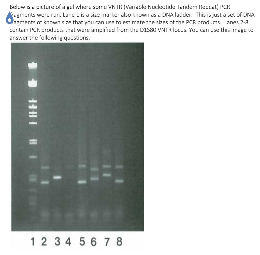 Solved Below is a picture of a gel where some VNTR (Variable | Chegg.com