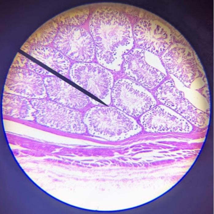 Testis slide Label Septa interstital cells, | Chegg.com