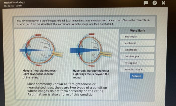 Solved Medical Terminology The Special Senses You have been | Chegg.com