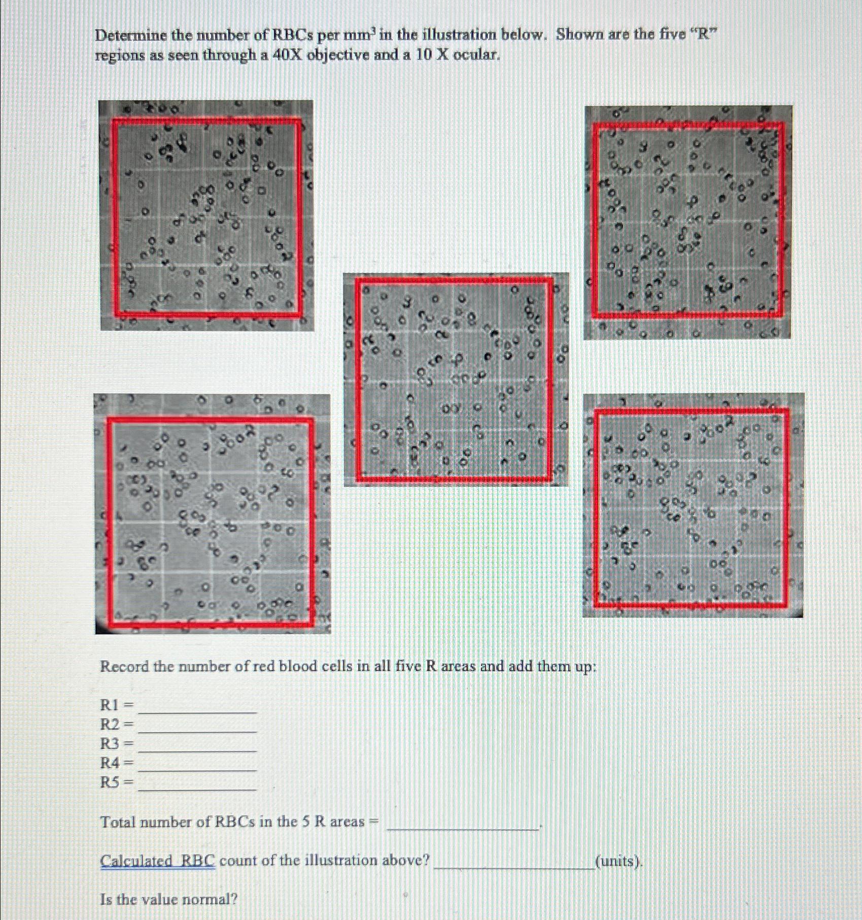 Determine the number of RBCs per mm^(3) in the | Chegg.com