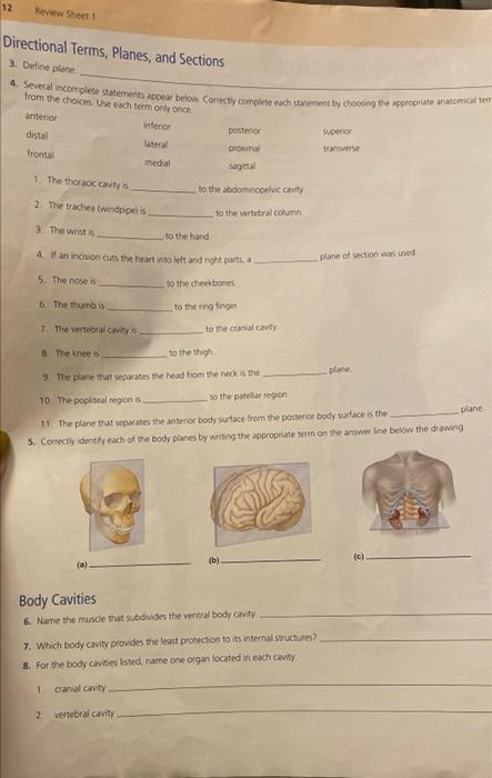 Solved 2. Use the regional terms to correctly label the body | Chegg.com